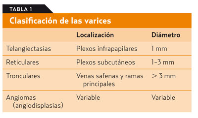 Varices Miembros Inferiores Pdf - newsmyfree